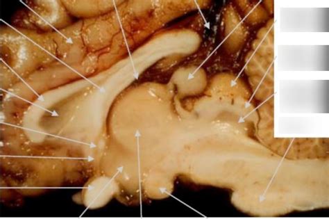 Lab Practicum Midsagittal Structures Diagram Quizlet Lab Practicum Midsagittal Structures Diagram Quizlet