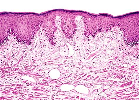 Epithelial Tissue Slide