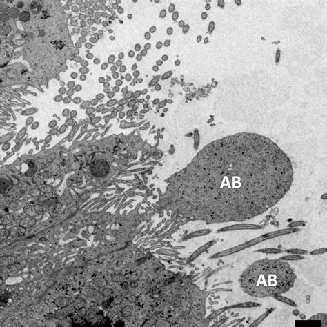 Human Epididymis Showing Evidences Of Apocrine Secretion In The