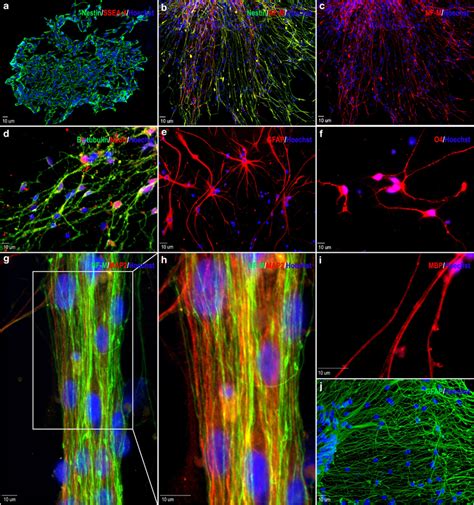 Neural Gene Expression In Differentiating Hesc Derived Neural