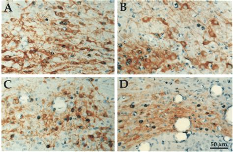 Photomicrographs Of The Ventral Tegmental Area A B And Download Scientific Diagram