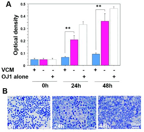 Vcm Removal From J774a Cell Culture With Oj 1 After The End Of Download Scientific Diagram