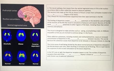 Solved Prefrontal Cortex Nucleus Accumbens Ventral Tegmental