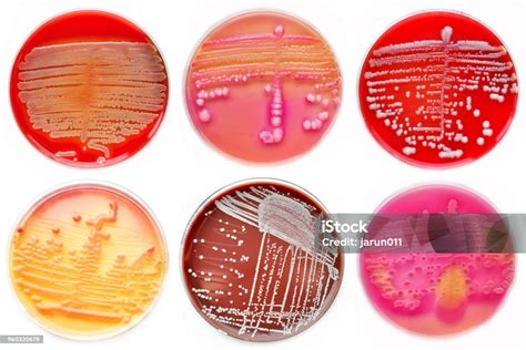 Petri Dish Bacteria Identification