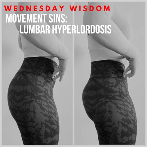 Wednesday Wisdom Movement Sins Lumbar Hyperlordosis Functional