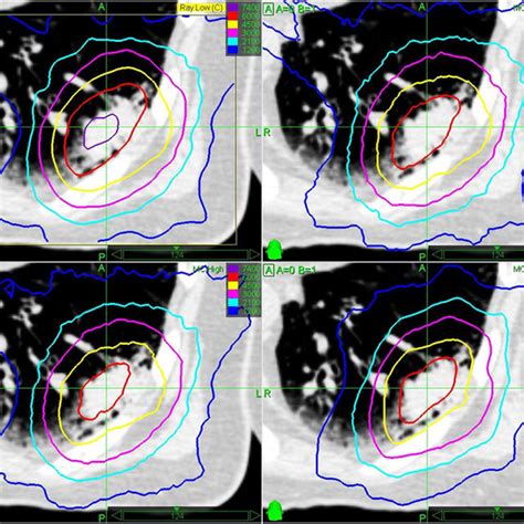 Integral Dose Calculations Differential Dose Volume Histogram Ddvh Download Scientific
