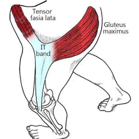 Itb Syndrome Iliotibial Friction Syndrome Adalah Salah Satu Penyebab