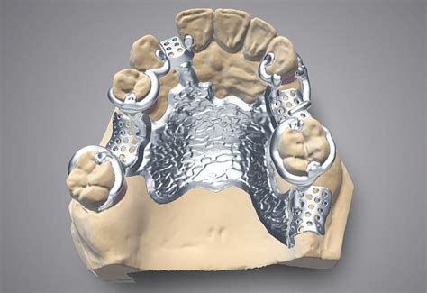 english partial frameworks cad4dent