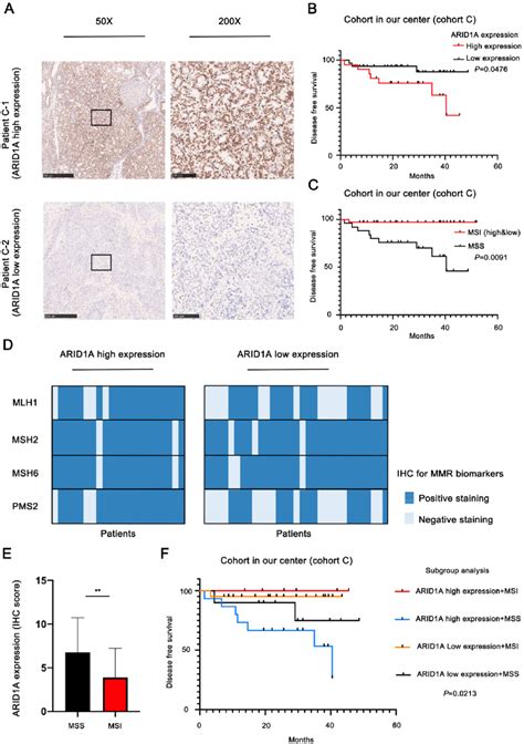 Arid1a Expression Loss Impairs Mmr And Is Related To Good Prognosis A
