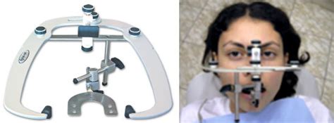 Bio Art Arco Facial Standard Odonto Busca