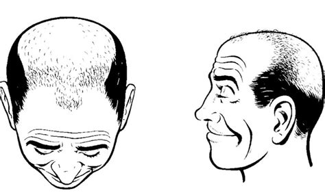 The Best Male Hair Loss Products In 2025 Infoguide Ghana