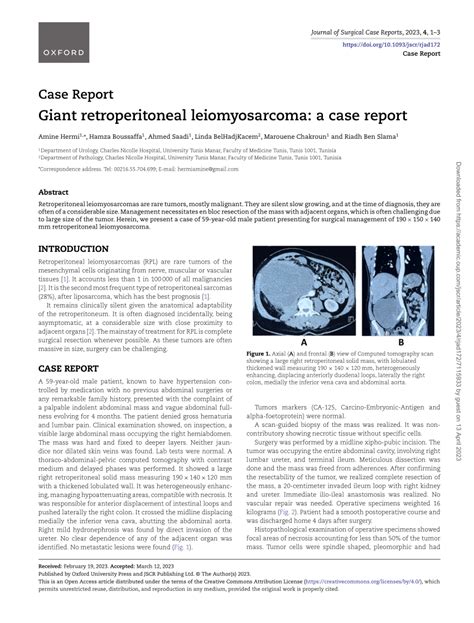 Pdf Giant Retroperitoneal Leiomyosarcoma A Case Report