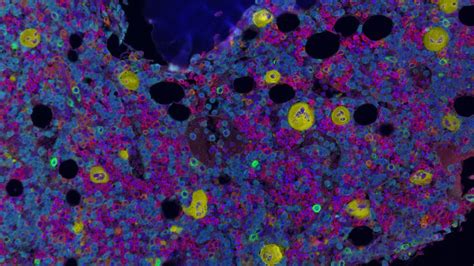 Researchers Chart The Contents Of Human Bone Marrow Cornell Chronicle