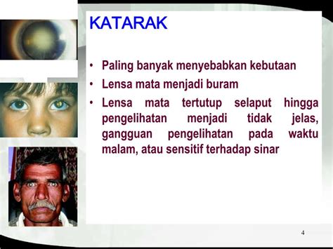 Ppt Bab Penyakit Mata Permasalahan Kesehatan Masyarakat Powerpoint Presentation Id