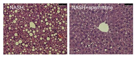 Duke Nus Preclinical Study Suggests Spermidi Eurekalert