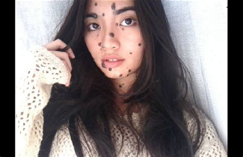 Woman Covered Head To Toe In Moles Strives For Miss Universe Malaysia