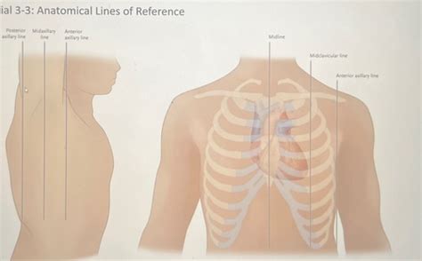 Ekg Chapter 3 And 8 Flashcards Quizlet