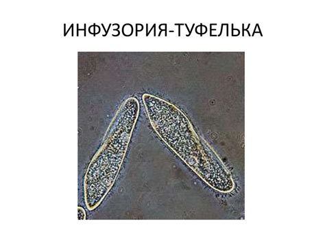 Амеба обыкновенная презентация онлайн
