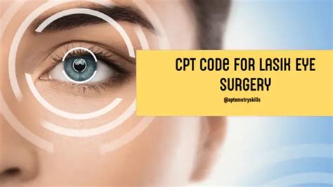 Cpt Code For Lasik Eye Surgery An Eye Care Blog