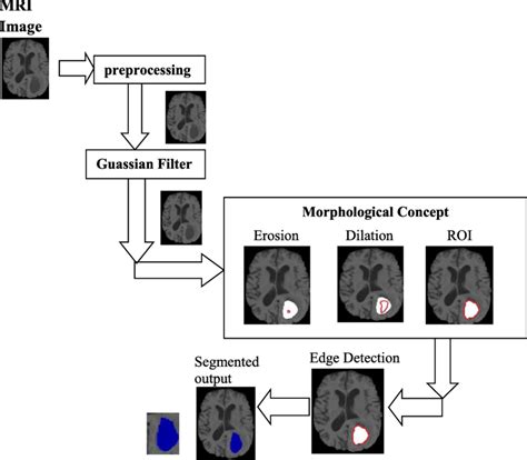 Flow Diagram For Edge Detection And Segmentation Download Scientific