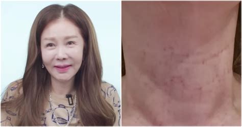 목주름 없애려고 성형시술 받은 배우 박준금의 현재 목 상태 사진·영상 위키트리