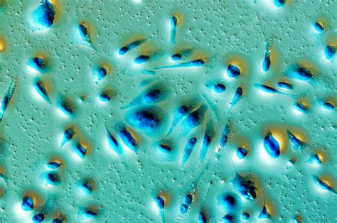 Pc 3 Human Prostate Cancer Cells Stock Image C0303261 Science