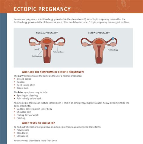 Ectopic Pregnancy System Disorder Template