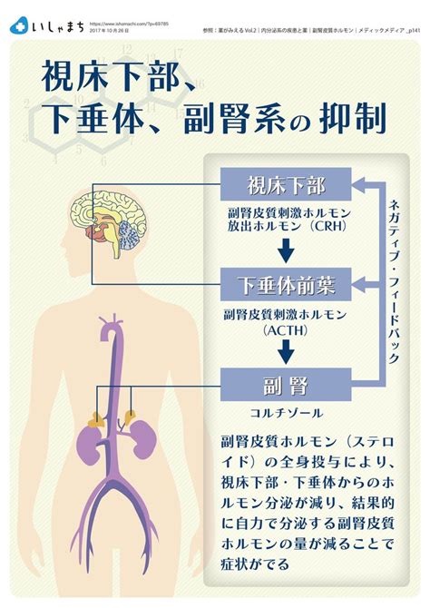 視床下部、下垂体、副腎系の抑制 Infographics 副腎 代替療法 看護ノート