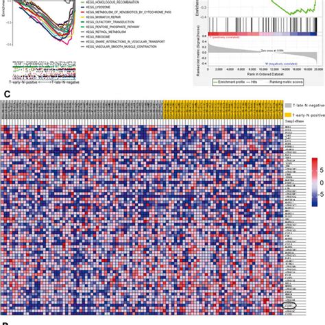 The Relationship Between Hp Infection And Lymph Node Metastasis In Gc