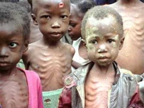Más de 155 millones de niños sufren desnutrición crónica Diario16