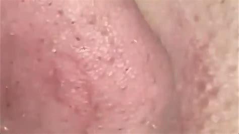 𝐏𝐚𝐢𝐧𝐬𝐭𝐚𝐤𝐢𝐧𝐠 𝐒𝐮𝐩𝐞𝐫 𝐒𝐚𝐭𝐢𝐟𝐲𝐢𝐧𝐠 𝐏𝐢𝐦𝐩𝐥𝐞 𝐏𝐨𝐩𝐢𝐧𝐠 Youtube