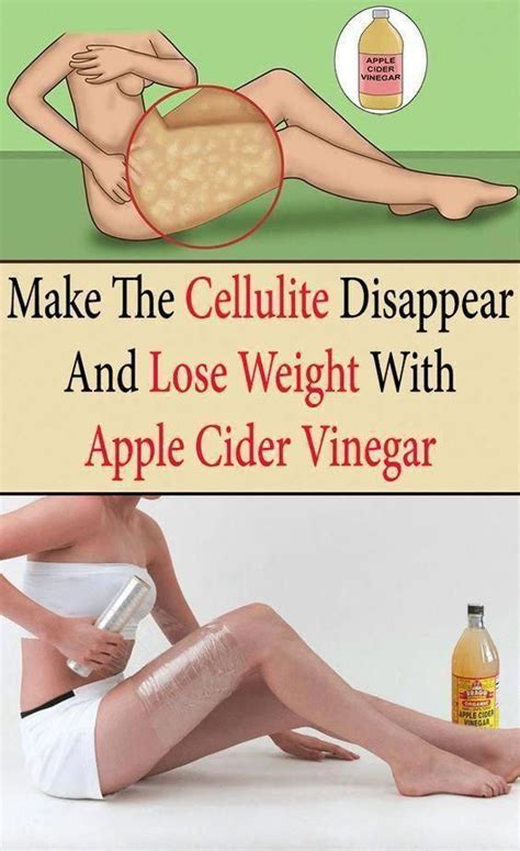 Pin On Cellulite Removal Before And After