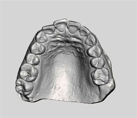 Archivo Stl Modelos Dentales Para Prácticas Listos Para Imprimir 🦷・plan