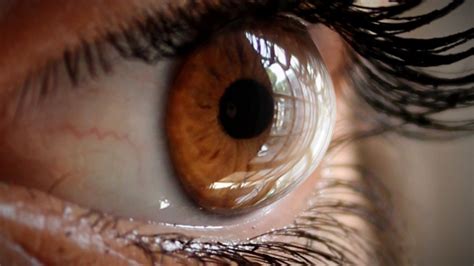 14 Worms Pulled From Eye Of Woman With Rare Infection