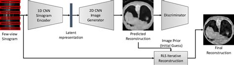 Figure 1 From Extreme Few View Ct Reconstruction Using Deep Inference Semantic Scholar