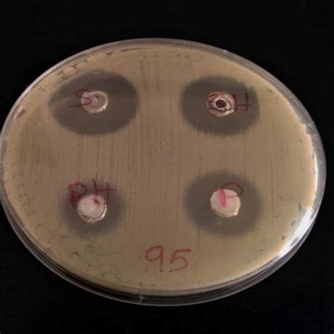 Agar Diffusion Method Showed The Antibacterial Activity Of Different