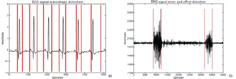 Graphic Example Of A Detected ECG Waveshapes And B EMG Onset And