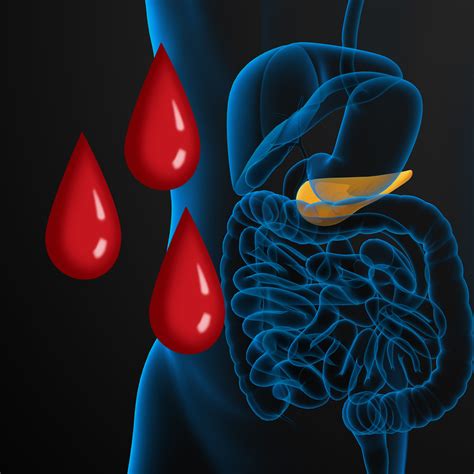 Trio Of Biomarkers Could Boost Early Detection Of Pancreatic Cancer