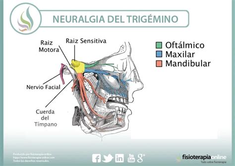Neuralgia del Trigémino Qué es causas síntomas tratamiento y