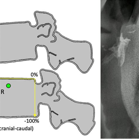 The Icor Is Measured In Percentage Relative To A Local Coordinate