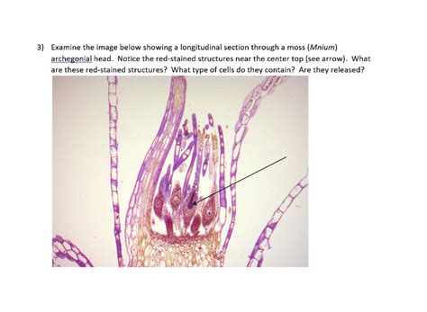Solved3 Examine The Image Below Showing A Longitudinal Section