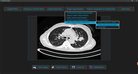 Github Ayazakymri Based Brain Tumor Classification Desktop