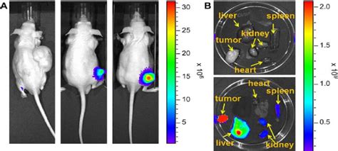 Memoire Online Les Nanomedicaments Une Approche Intelligente Pour Le Traitement Du Cancer