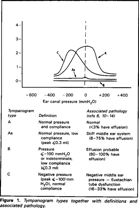 Otitis Media With Effusion Audiogram