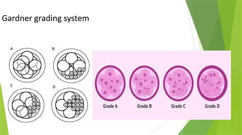 Ppt Embryo Grading And Art Summarypptx