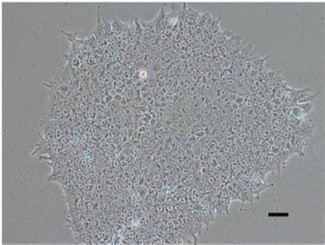 Characteristics Of Urine Hipscs A The Schematic Of Reprogramming