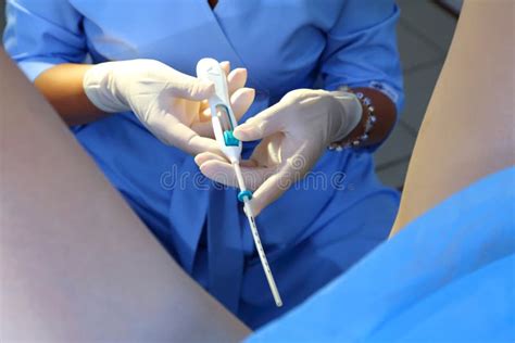 rixa anticoncepcional o ginecologista instala uma iud imagem de stock