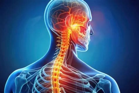 Chronic Cervical Radiculopathy Physiotherapist India