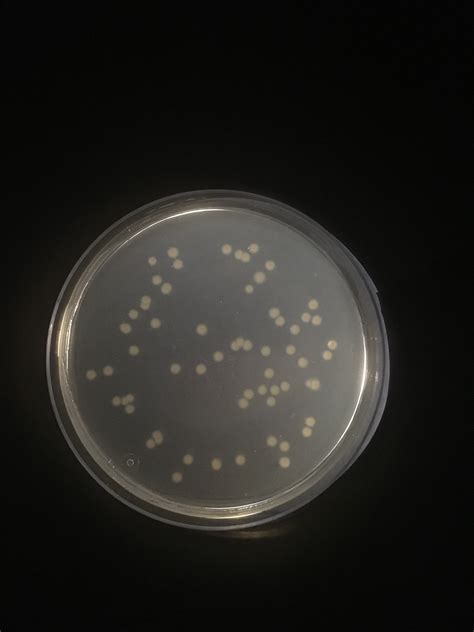 BACTERİA DATASET Object Detection Dataset and Pre Trained Model by imageticket