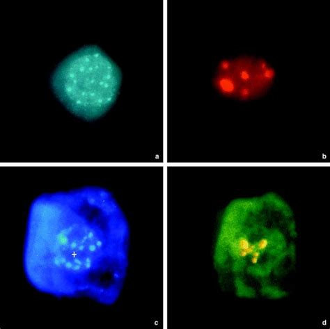 B Vulgaris Ssp Arcuata G Type A Dapi Stained Interphase Nucleus